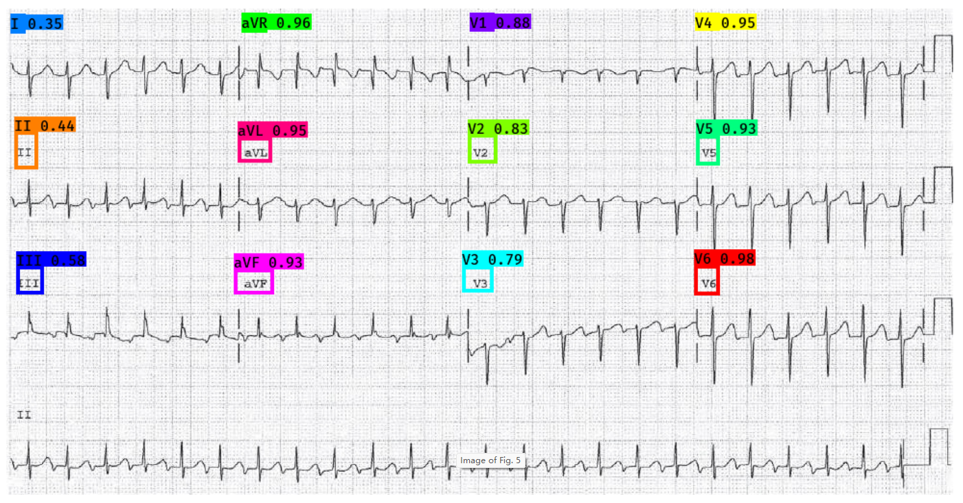 多分支融合网络用于12导联ECG图像心肌梗死筛查_针对心梗的ecg识别竞赛-CSDN博客