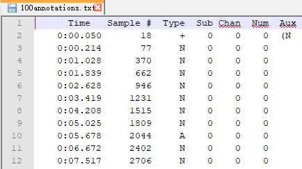 MIT-BIH介绍（二）什么是MIT-BIH？-CSDN博客