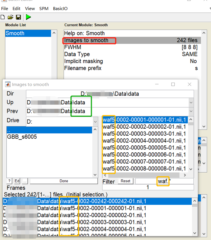 SPM数据预处理【“傻瓜”操作版】-CSDN博客