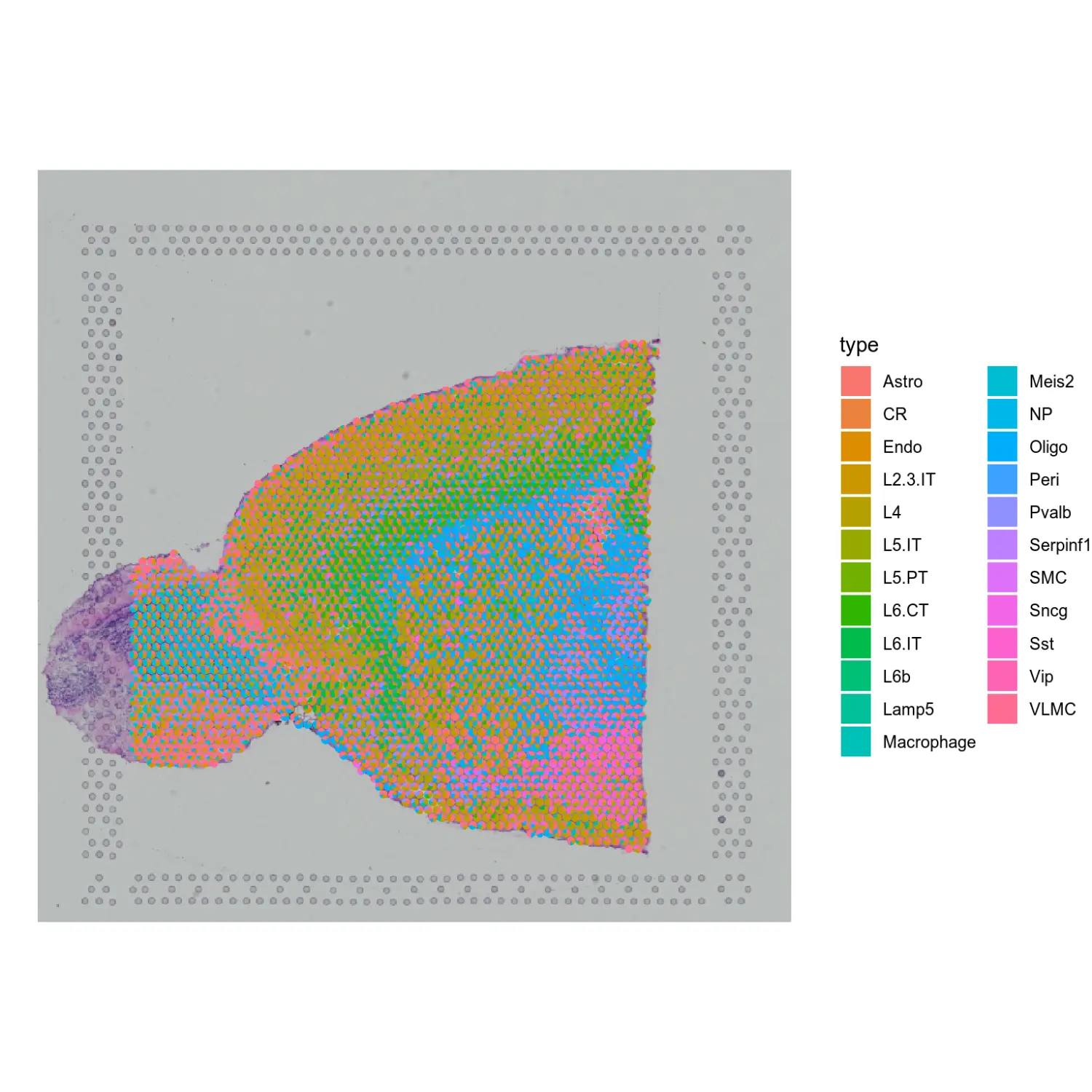 10X单细胞空间联合分析之三----Spotlight_spotlight分析-CSDN博客