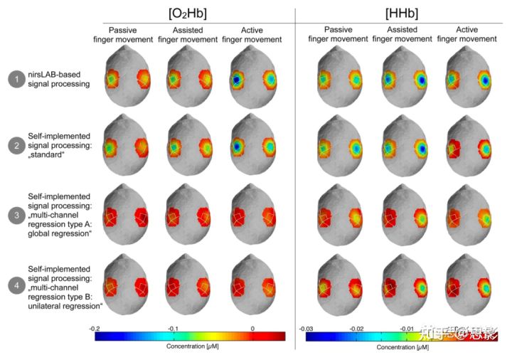 fNIRS信号处理方法的统计结果差异_fnirs处理homers-CSDN博客