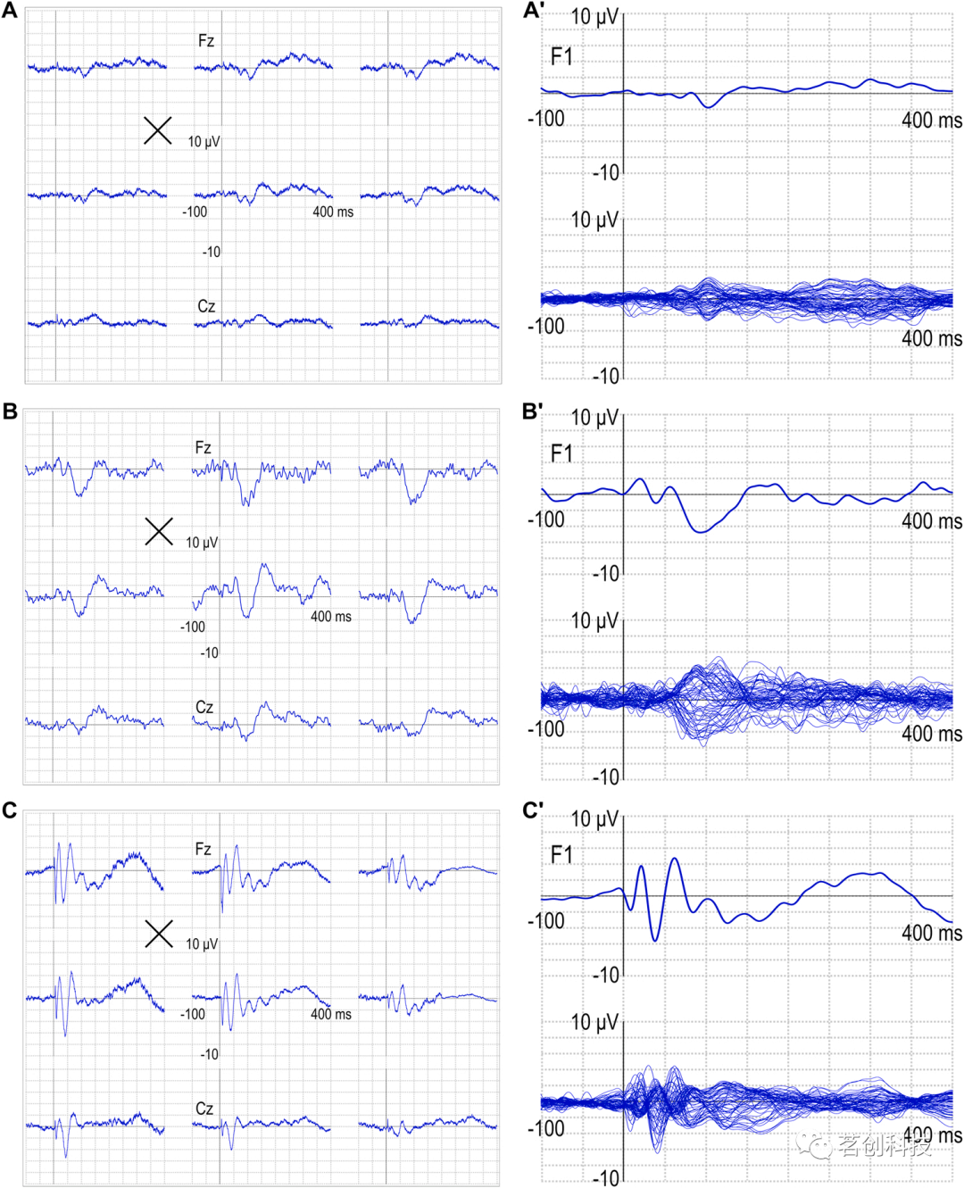 rt-TEP工具：实时显示TMS诱发电位，最大化皮层激活和最小化伪影_肌电诱发 tep-CSDN博客