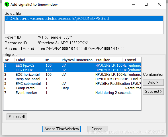 edfread matlab,Sleep-EDF Database Expanded 读取-CSDN博客