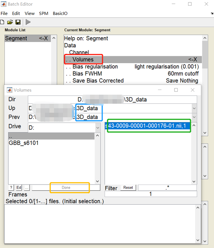 SPM数据预处理【“傻瓜”操作版】-CSDN博客