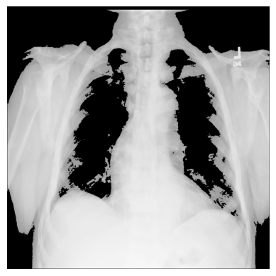 NumPy 应用：X射线图像处理_射线扫描里面的grayscale plot-CSDN博客