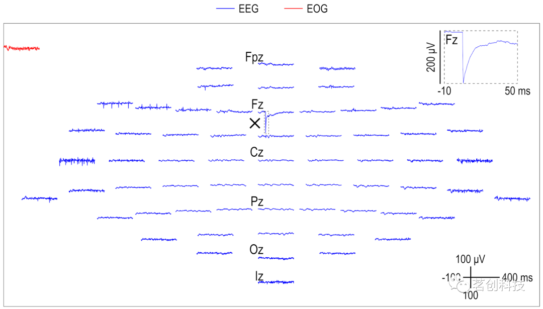 rt-TEP工具：实时显示TMS诱发电位，最大化皮层激活和最小化伪影_肌电诱发 tep-CSDN博客