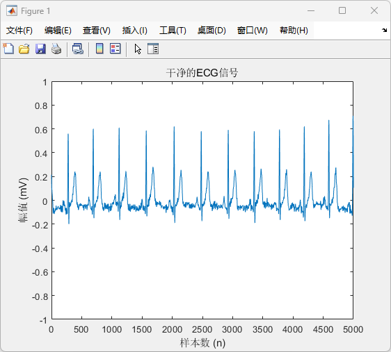 基于Matlab自适应滤波的心电信号噪声消除算法研究与实现_用lms算法去心电信号噪声为什么滤波后的幅值变化了-CSDN博客
