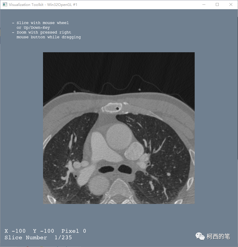 VTK实现DICOM简单阅片-CSDN博客