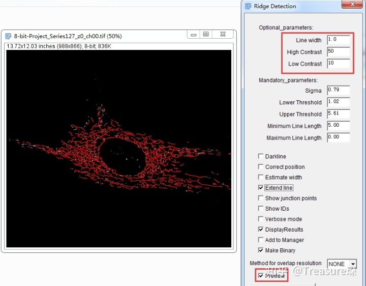 imagej中文_ImageJ实用技巧——线粒体网络形态分析(插件篇)_科技美学的博客-CSDN博客
