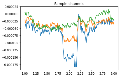 脑电分析系列[MNE-Python-7]| Python读取.edf文件-CSDN博客
