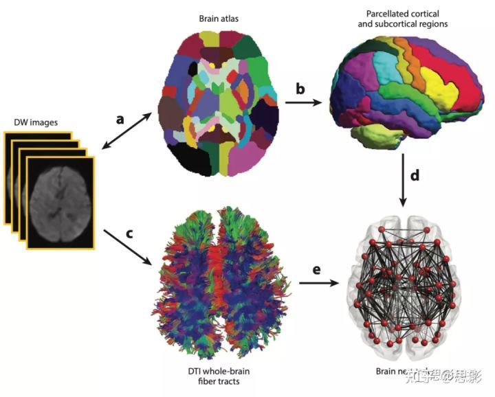 DTI在早期脑发育研究中的应用_dti指标示意图-CSDN博客