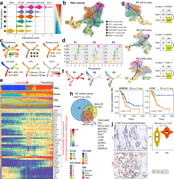 IF：16+ 基于 scRNA-seq 研究免疫抑制肿瘤微环境与胰腺癌肝转移的相关性-CSDN博客