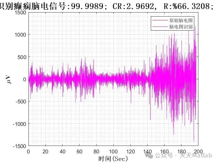 【癫痫检测】基于小波分析EEG实现癫痫发作信号检测附Matlab代码_eeg matlab topomap-CSDN博客