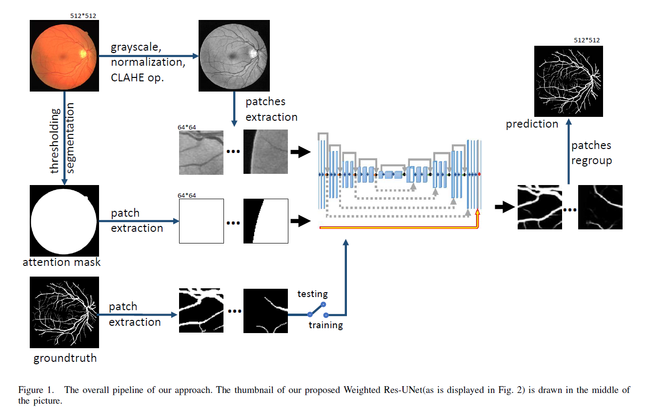 基于加权的Res-UNet注意力机制分割视网膜血管分割挑战_unet加注意力机制-CSDN博客