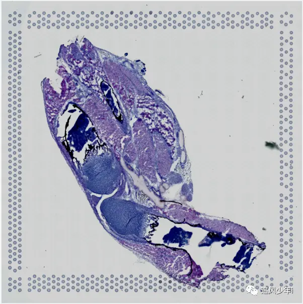 10X空间转录组数据分析之细胞百分比饼图的绘制_怎么更改空间转录组的图像的配色-CSDN博客