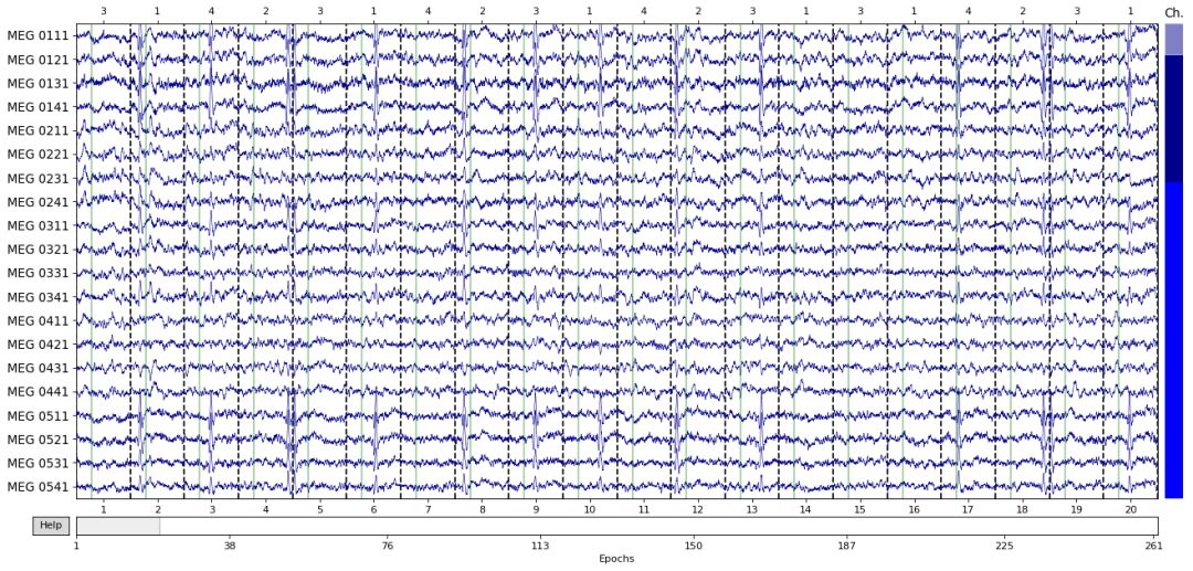 脑电数据的Epoching处理-CSDN博客