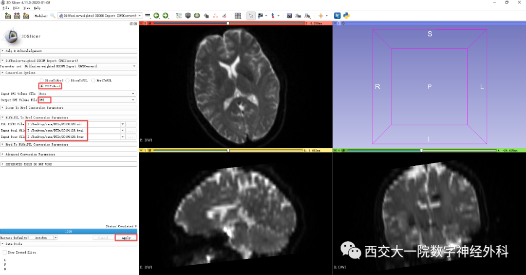 dicom格式是什么_多张DTI原始图像为一个DICOM文件的如何导入-CSDN博客