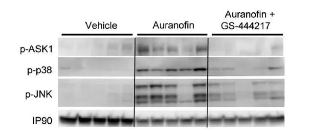 ASK1在氧化应激条件下的激活_ask1的磷酸化位点thr845 ser966 jnk p38-CSDN博客