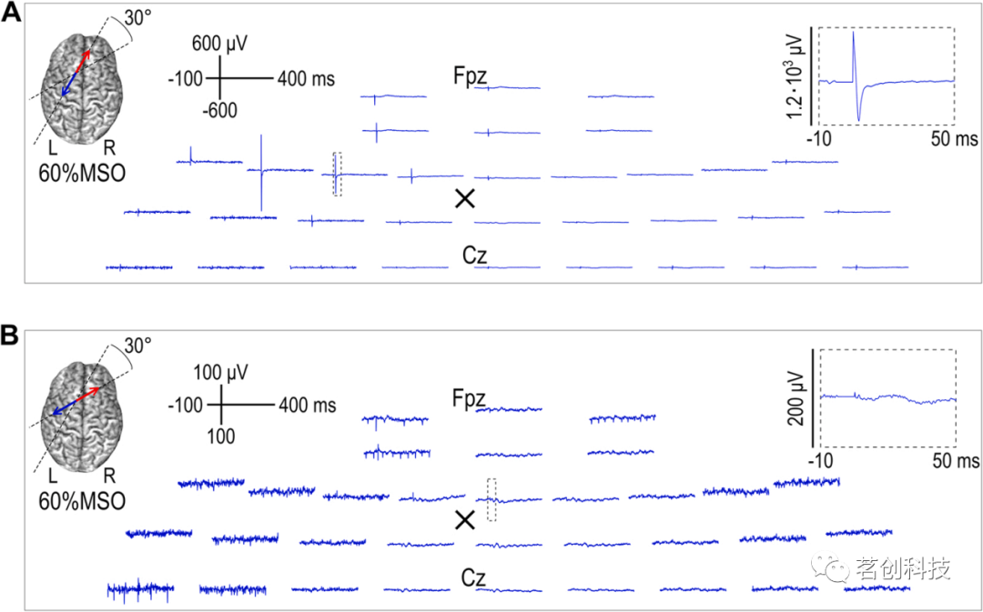rt-TEP工具：实时显示TMS诱发电位，最大化皮层激活和最小化伪影_肌电诱发 tep-CSDN博客
