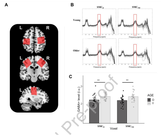 与年龄相关的反应时间增加和GABA水平的作用下（前）运动网络的神经生理调节：TMS-MRS双模态研究_gaba 执行功能-CSDN博客