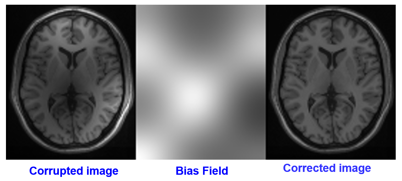 vbm 分析_MRI脑影像分析从哲学到技术：一文搞懂VBM预处理基本原理（全网最详细解析）..._weixin_39742392的博客-CSDN博客