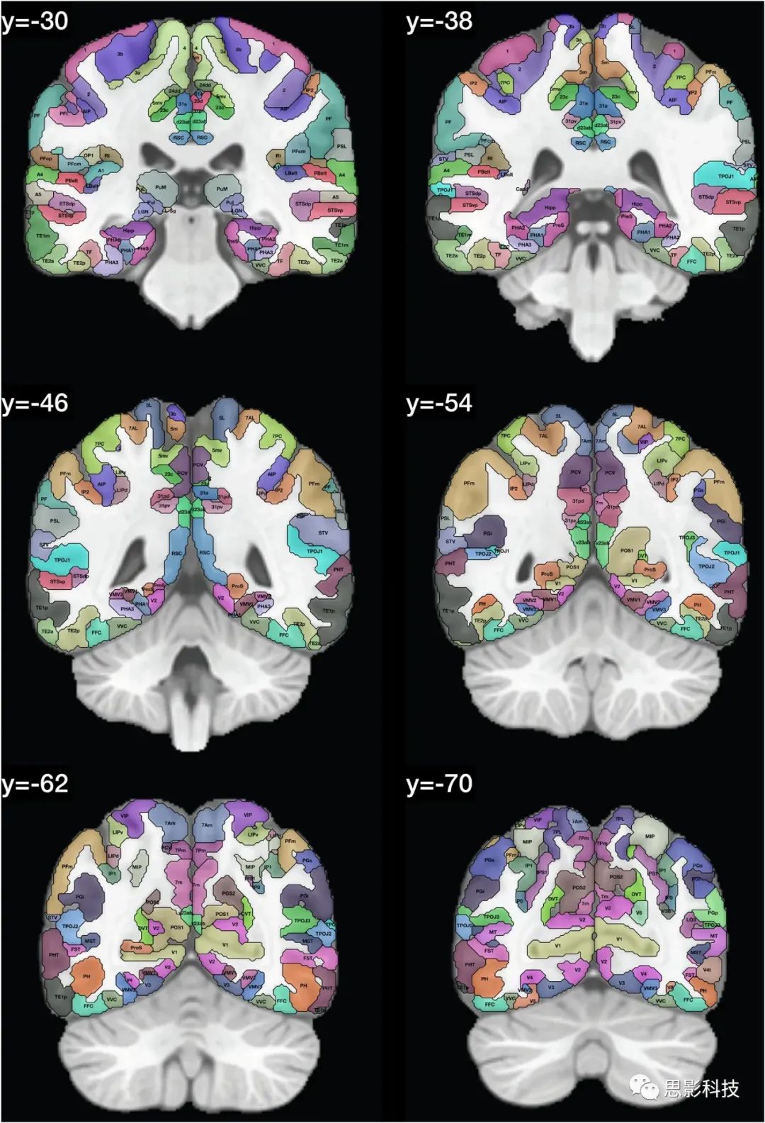 人类连接组计划扩展版的多模态皮层及皮层下区域细分图谱_hcp的脑区1-360list-CSDN博客