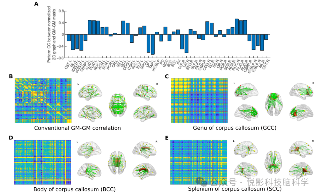 Science Avances：缺失的第三维度—白质BOLD信号的功能相关性-CSDN博客