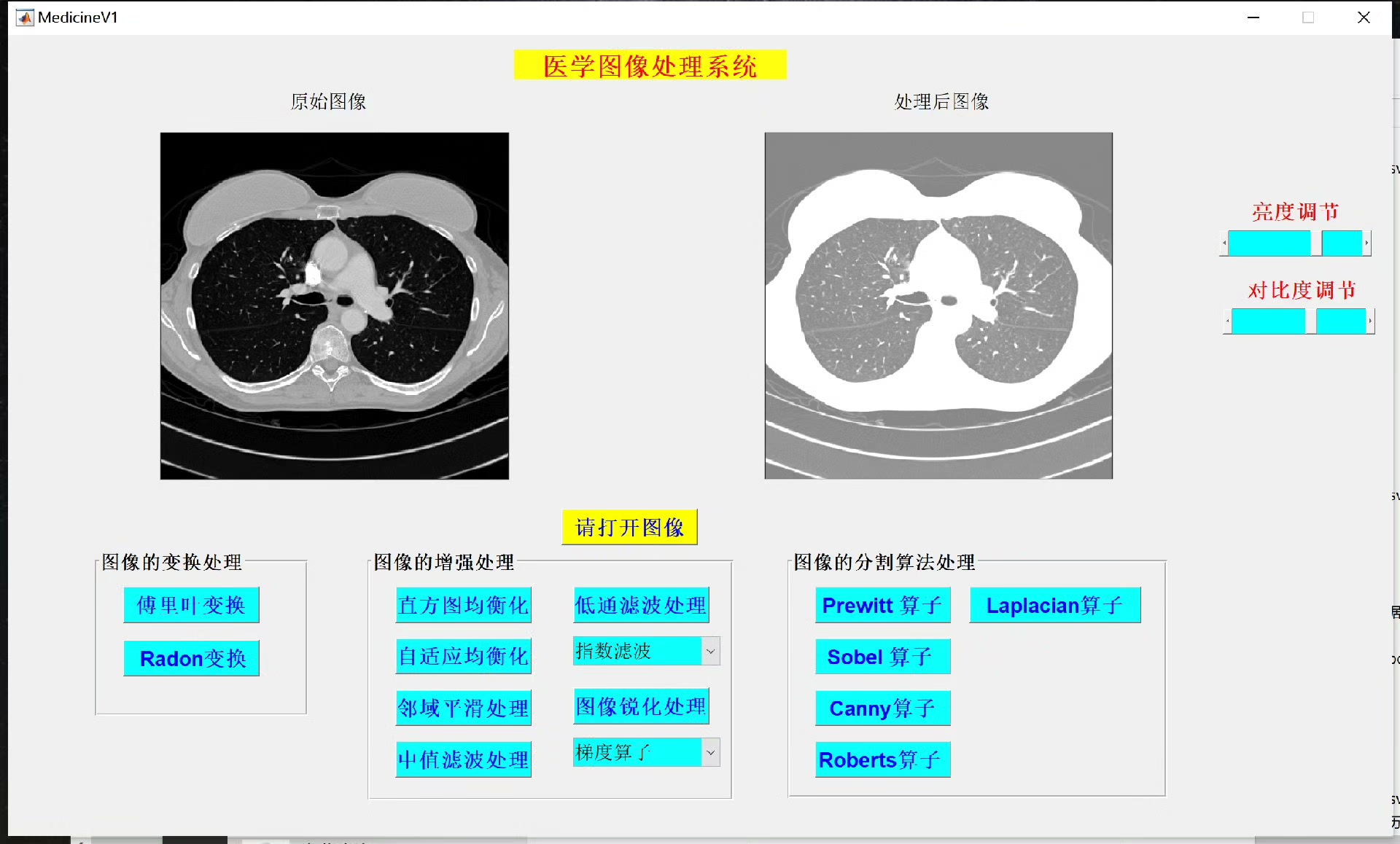 探索医学图像处理之道——基于matlab的实践与应用,探索基于matlab的医学图像处理技术与应用利用基于锚点图的医学图像处理的界面 Csdn博客
