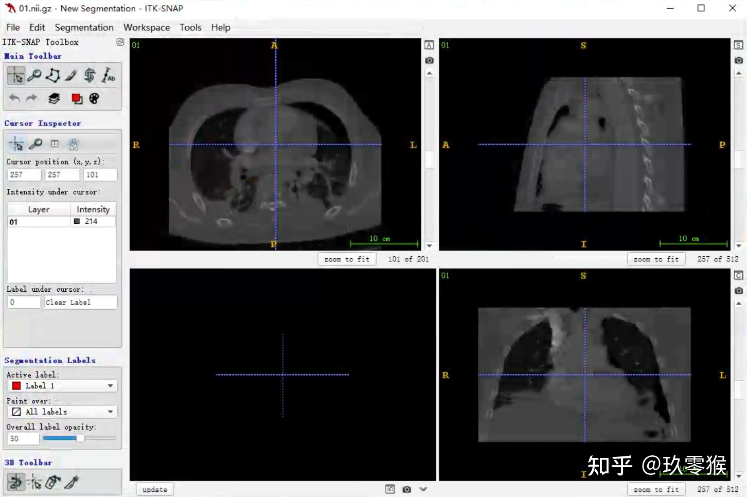 医学图像2D/3D可视化 ITK-SNAP软件使用-CSDN博客