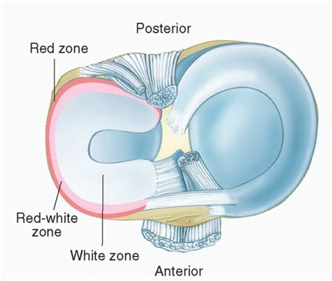 半月板知识_内侧半月板后角属于红区还是白区-CSDN博客