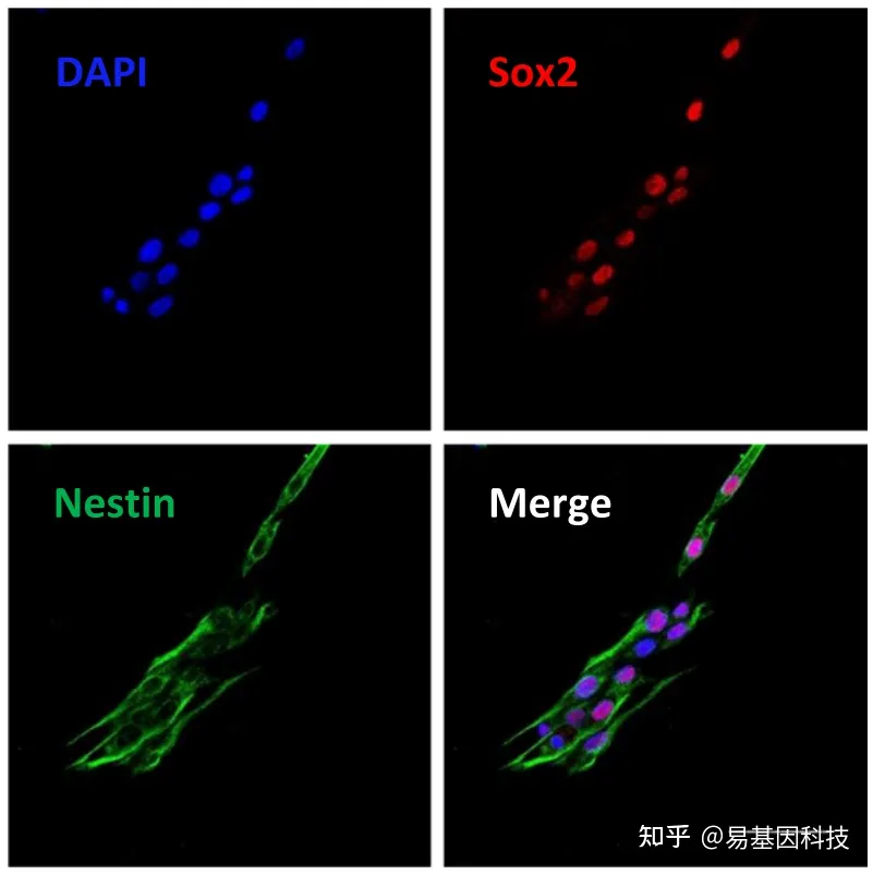 易基因：RNA-BS揭示叶酸调控神经干细胞m5C修饰和mRNA翻译机制｜科研速递-CSDN博客
