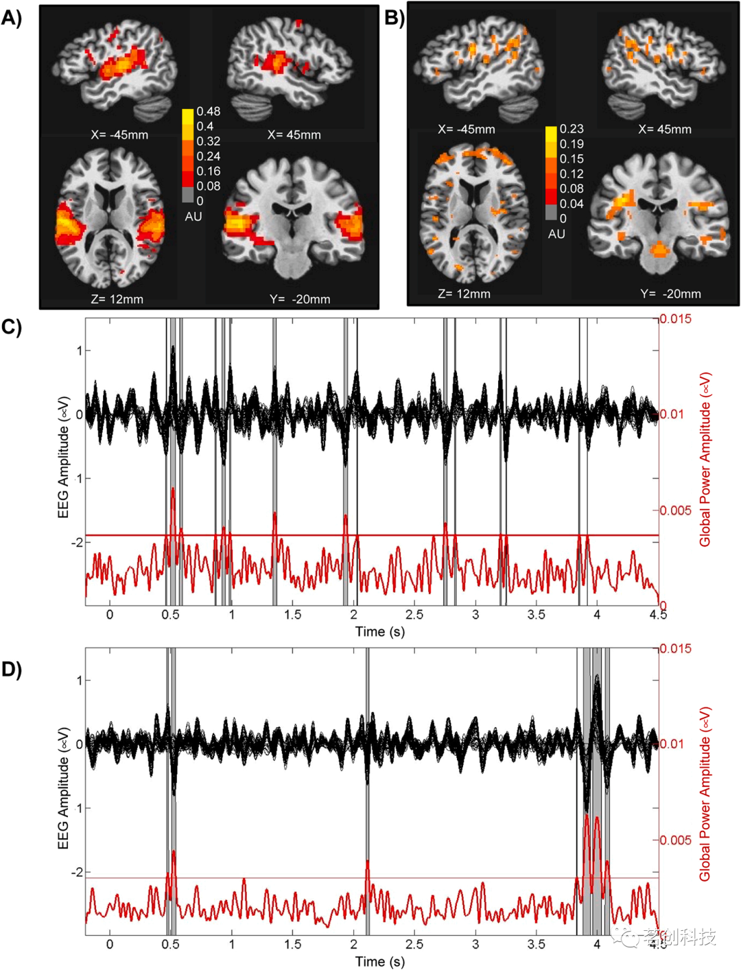 基于联合独立成分分析(jICA)的EEG与fMRI耦合与解耦_脑电信号解耦-CSDN博客