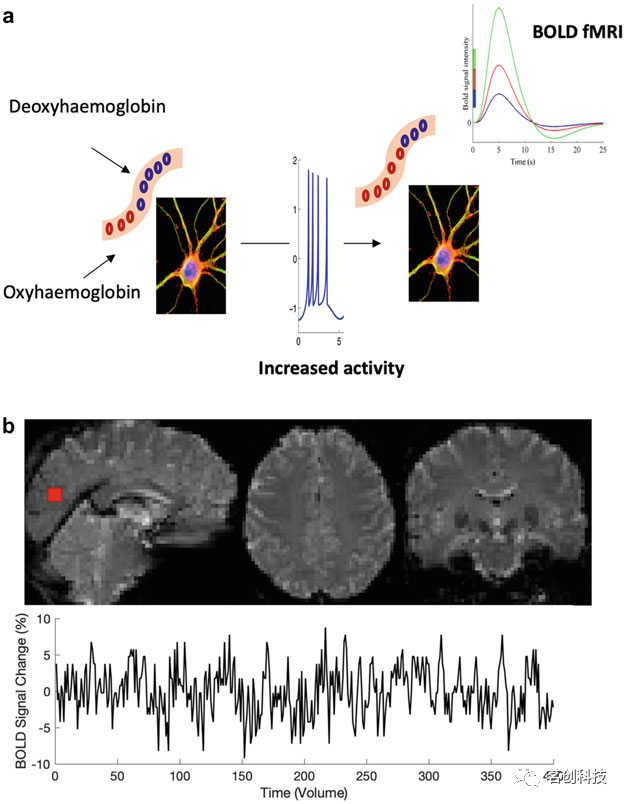 多模态神经成像之EEG-fMRI同步_fmri和eeg结合使用-CSDN博客