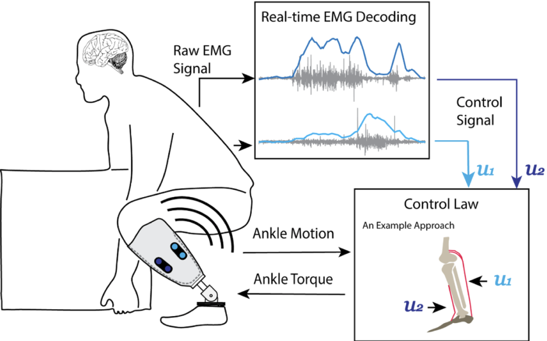 EMG控制的下肢神经义肢：新兴技术与潜在挑战_假肢腿类似的emg信号处理与控制-CSDN博客