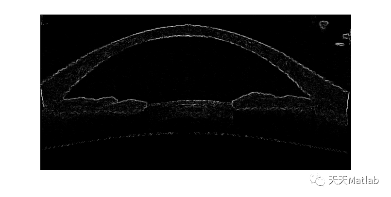 【图像分割】眼前节组织OCT图像边缘检测及特征角点提取matlab代码_oct图像算法-CSDN博客