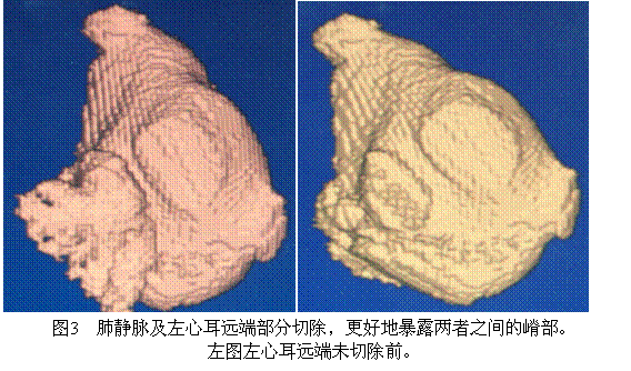 计算机技术中的图像融合,刘少稳:图像融合技术（CARTO-Merge）的应用方法_复旦大学附属中山医院_ 刘少稳 林佳雄 _365心血管网 ...