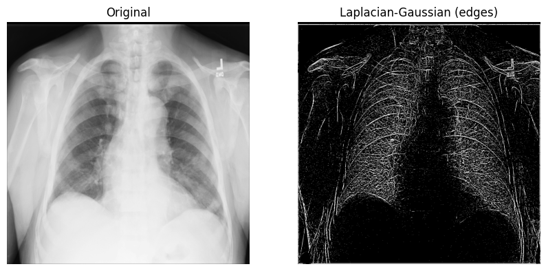NumPy 应用：X射线图像处理_射线扫描里面的grayscale plot-CSDN博客