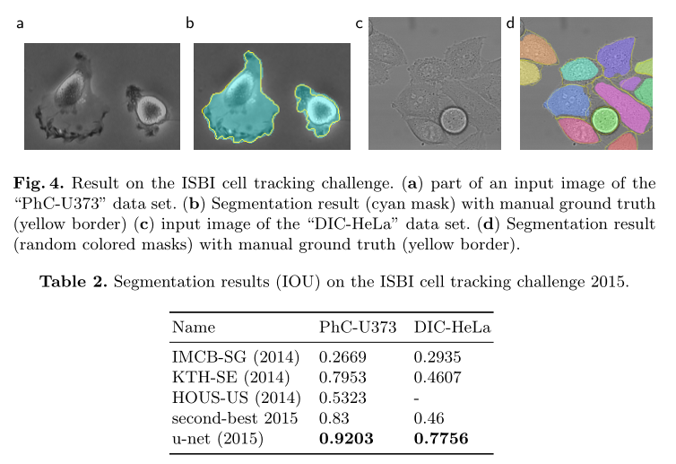 2015-UNet论文翻译_isbi 2015 cell tracking challenge-CSDN博客