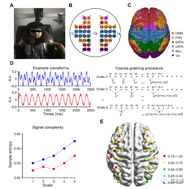 Neurolmage:儿童和青春期早期大脑内在活动的复杂度_aal模板对应mni坐标-CSDN博客