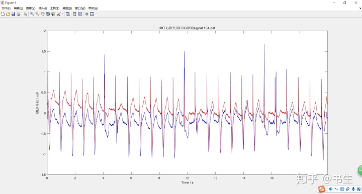 Matlab Dat文件读取matlab下对mit Bih数据库中212格式ecg读取 Csdn博客