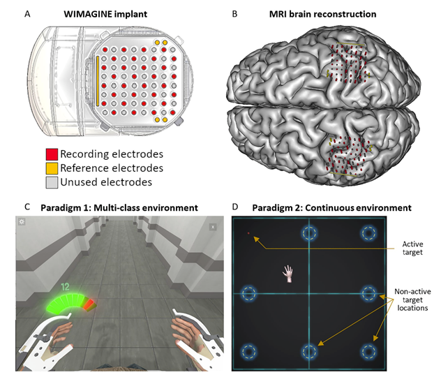 Nature子刊：对EcoG脑机接口进行无监督适应-CSDN博客