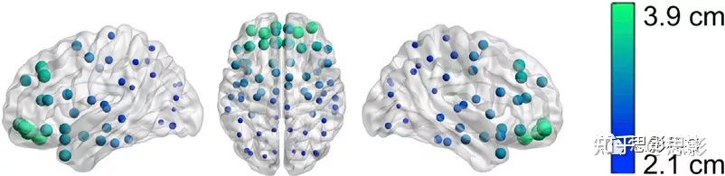 比较脑磁图与高密度脑电图的内在功能连通性_meg不符-CSDN博客