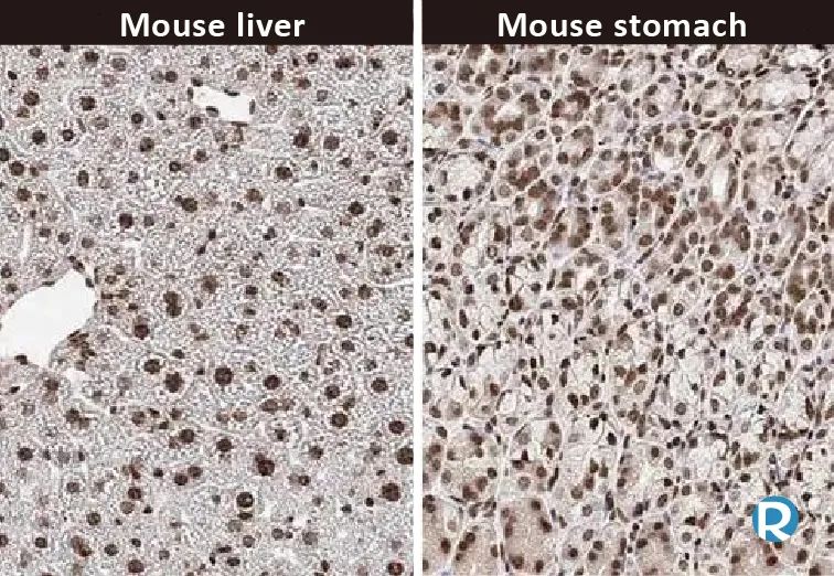 IFNγ刺激的KAT8-IRF1凝聚体可激活PD-L1表达并促进免疫逃逸-CSDN博客