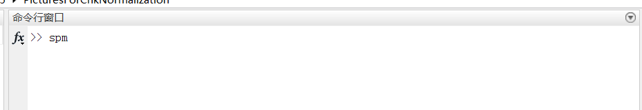 SPM数据预处理【“傻瓜”操作版】-CSDN博客