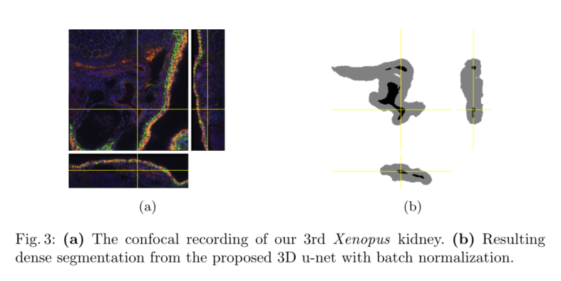 3D U-Net论文笔记_3dunet论文-CSDN博客