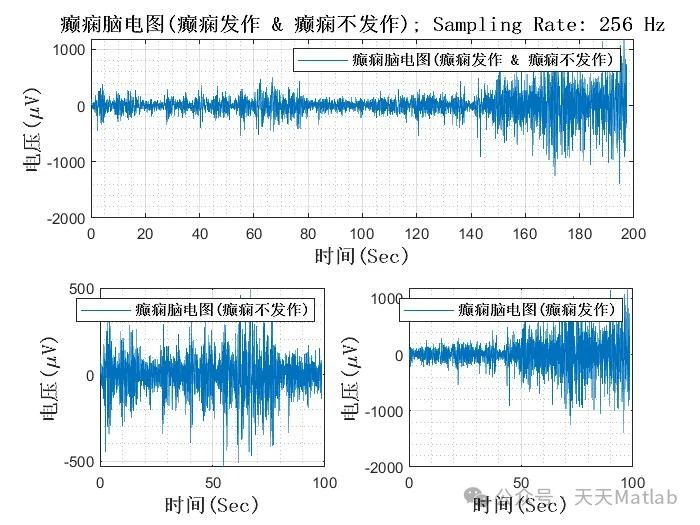 【癫痫检测】基于小波分析EEG实现癫痫发作信号检测附Matlab代码_eeg matlab topomap-CSDN博客