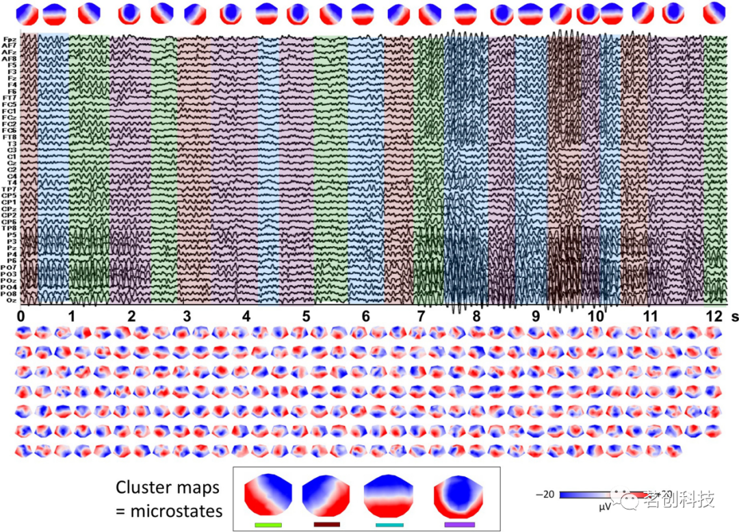 高分辨率EEG的空间分析-CSDN博客