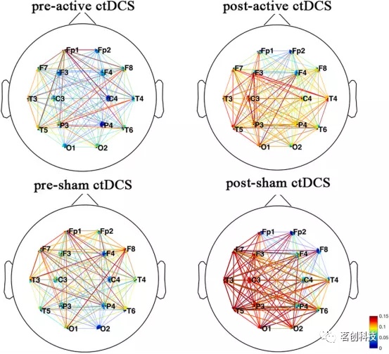 新文联播第8期 | tDCS可改善强迫症症状，调节皮层抑制_tdcs功能思维导图-CSDN博客