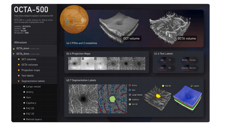 OCTA-500：用于光学相干断层扫描血管造影研究的视网膜数据集|文献速递-基于生成模型的数据增强与疾病监测应用_octa500数据集解压密码-CSDN博客