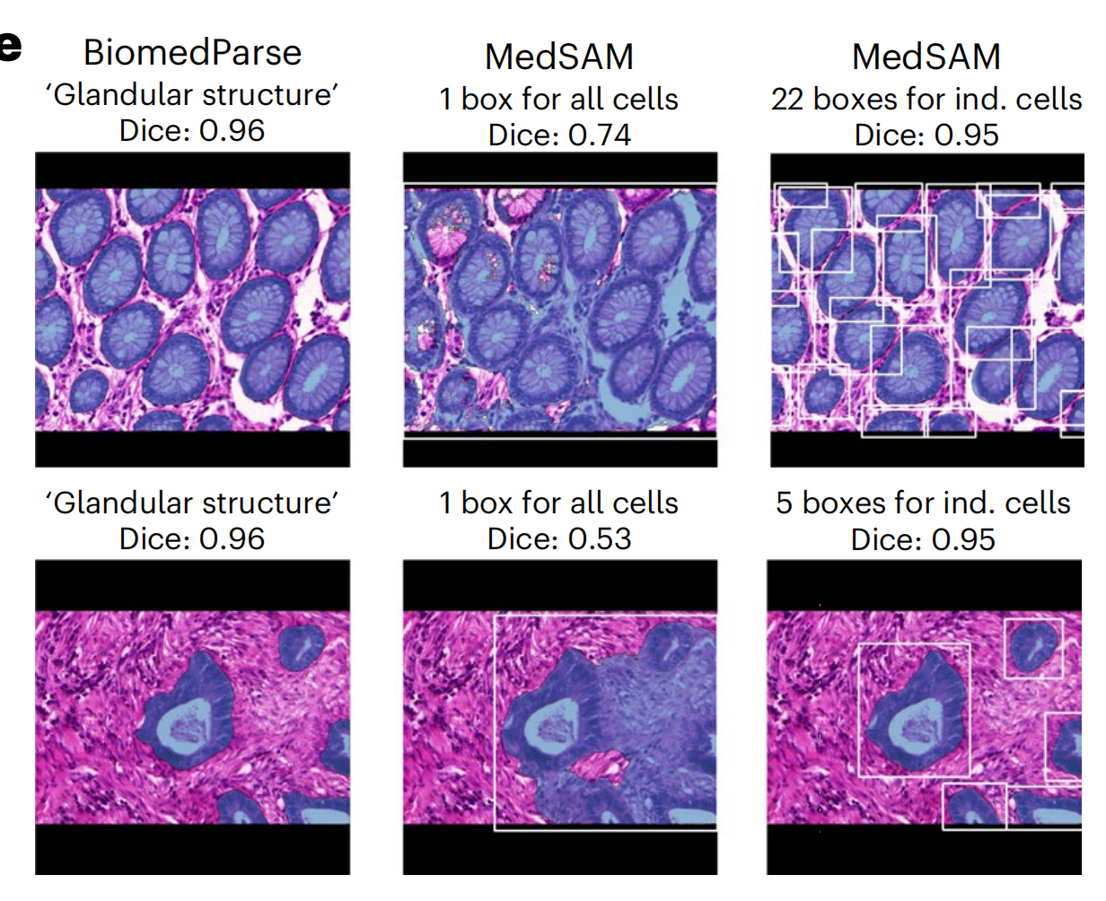 BiomedParse：跨模态生物医学图像分析的基础模型｜顶刊精析·24-11-20-CSDN博客